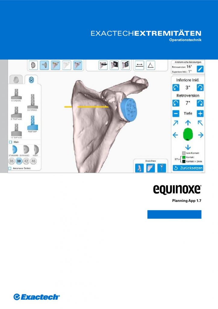 Equinoxe Planning App Operationstechnik - ch.exac.com